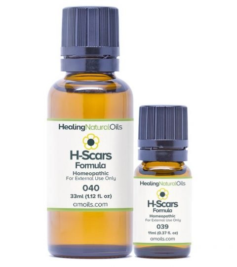 Hypertrophic Scars - What Are They and How to Get Rid of Them - Health ...