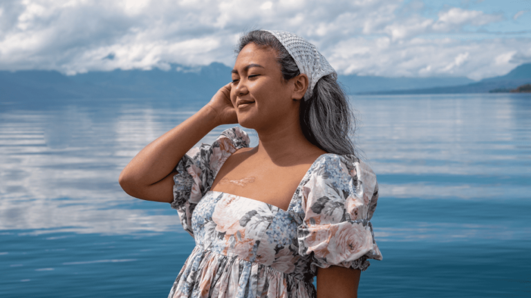 How to Prevent Keloids: Embracing Natural Remedies for Healthy Skin ...